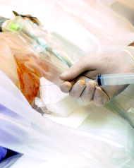 Testez vos connaissances sur la ponction biopsie hépatique (1) | Le ...