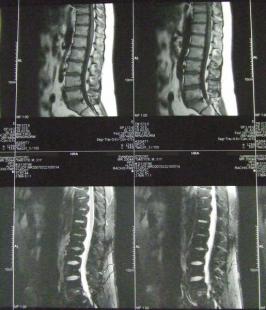 L'anomalie de Modic en huit questions essentielles | Le Quotidien du ...