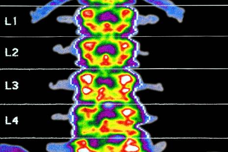 Terrosa : un stylo prérempli en remplacement du stylo rechargeable | Le ...
